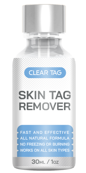 TOP Skin Tag Removers